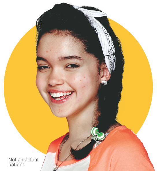 Safety & Tolerability | WINLEVI® (clascoterone) cream 1% for HCPs